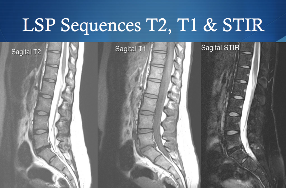 MRI Training - Go2imaging